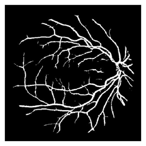 Segment Results A Original Image B Proposed Algorithm C