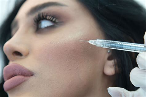 Cheek Enhancement The London Cosmetic Clinic