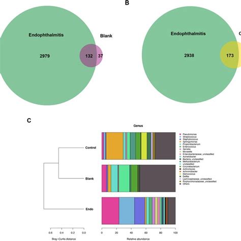 Combined Analysis Of 16s Rdna Sequencing Results From Endophthalmitis Download Scientific