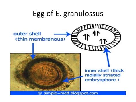 Echinococcus Granulosus Egg Cystic Echinococcosis Hydatid Disease
