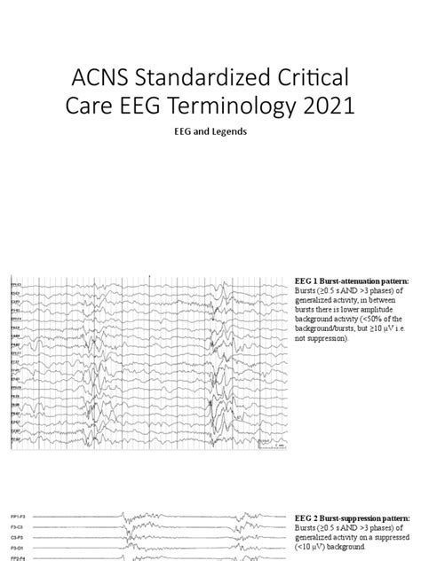 Acns Standardized Critical Care Eeg Examples 2021 Pdf