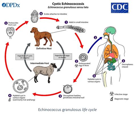 Echinococcosis Ldbio Diagnostics