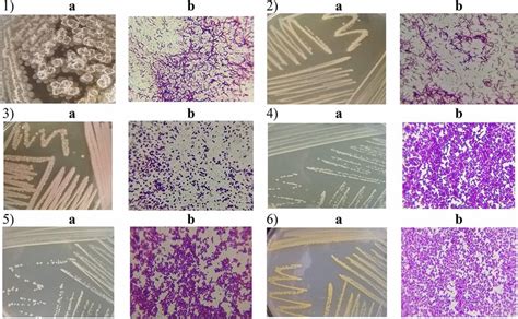 The Macroscopic Phenotypic Characteristics Of Isolated Colonies A And