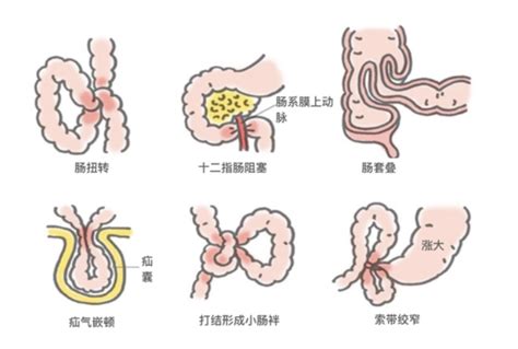 河源市人民医院网站 你竟然不知道肠道也会“塞车”？