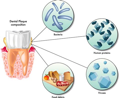 What Is Gum Disease The California Society Of Periodontists