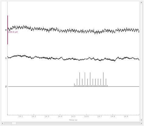 Eeg Reading Lasopaapp