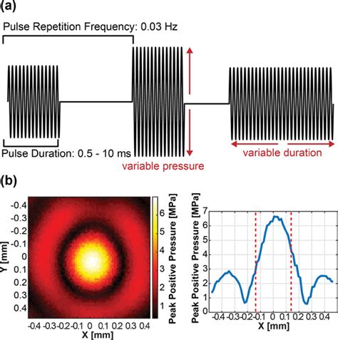 Displacement Imaging For Focused Ultrasound Peripheral Nerve Neuromodulation Pmc
