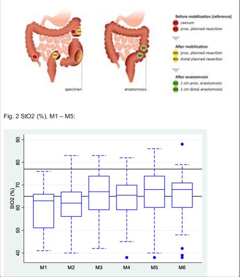 Perfusion Measurement Protocol Download Scientific Diagram