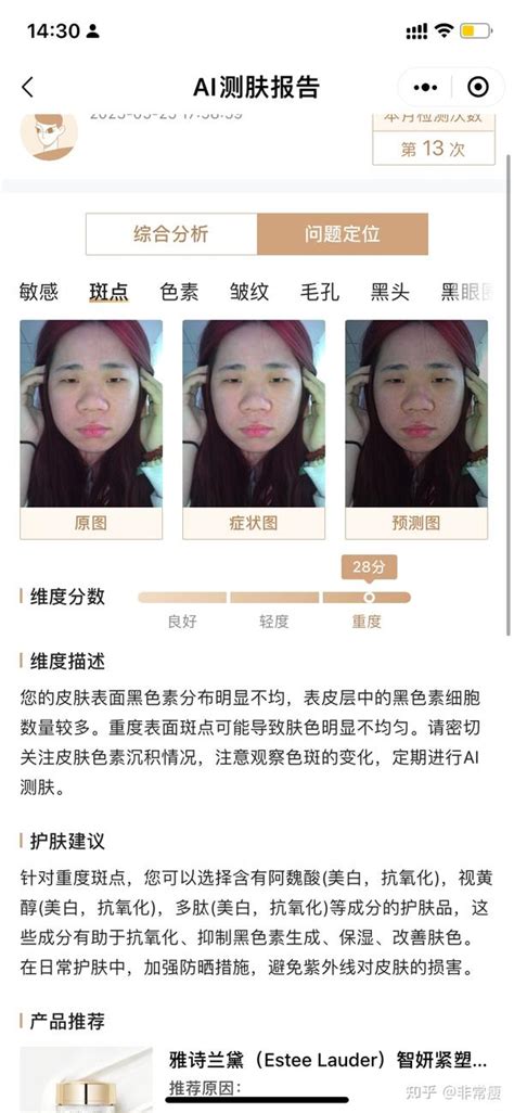 护肤必备的家用测肤镜喜境simetra真的有用吗 知乎