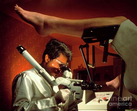 Coloscopy Laser Operation On A Womans Cervix Poster By Science Photo