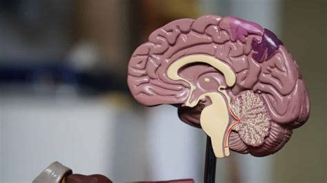 Improving The Interpretability Of Fmri Decoding Using Deep Neural