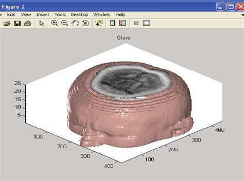Figure 1 From Survey For 3 D Reconstruction Of Brain Mri Images Semantic Scholar