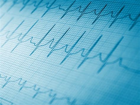 Psvt Heart Symptoms Causes Treatment And More Psvt Heart Symptoms Causes Treatment And More