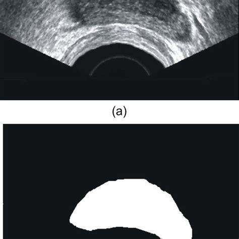 pdf a reinforcement learning framework for medical image segmentation