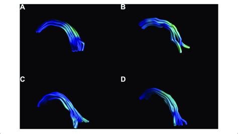 Examples Of Intersubject Variability Of Sm Reconstruction Note That Download Scientific