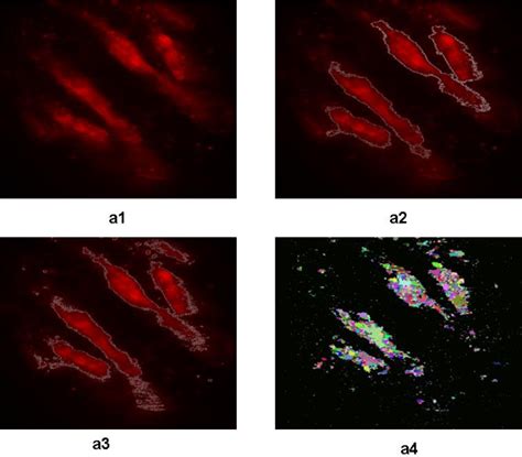 Figure 4 From An Enhancement Neighborhood Connected Segmentation For 2d Cellular Image