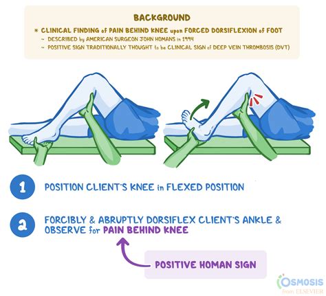 Homan Sign What Is It Uses And More Osmosis