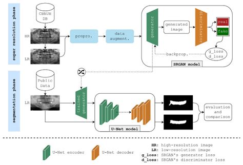Integrating Super Resolution With Deep Learning For Enhanced Periodontal Bone Loss Segmentation