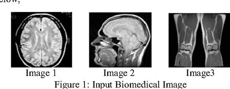 Figure 1 From Comparison Analysis Of A Biomedical Image For Compression Using Various Transform