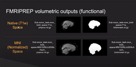 Github Nani757mri Analysis With Python What Is Mri Data Analysis