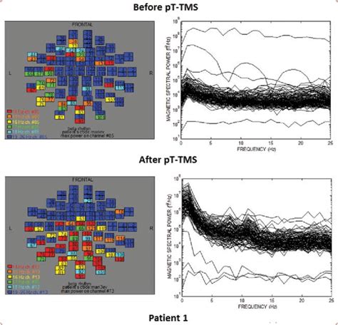 The Maps And Overlapping Of Power Spectra Before And After Pt Tms For Download Scientific