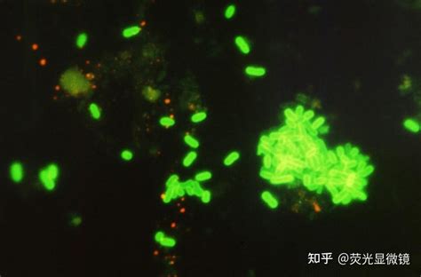 显微镜能怎样看细菌？ 知乎