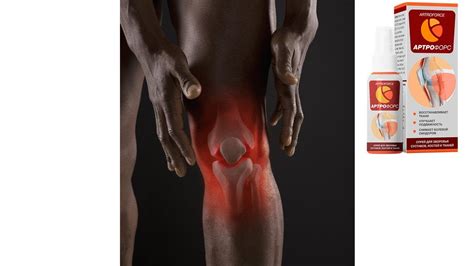 Артрофорс Для Суставов Реальные Отзывы Цена Youtube