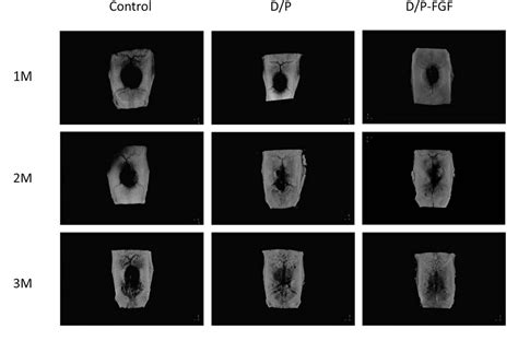 Figure 3 From Evaluation Of Bone Formation Guided By Dna Protamine Complex With Fgf 2 In An