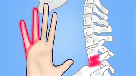 Изтръпване на ръцете и 7 възможни причини за това