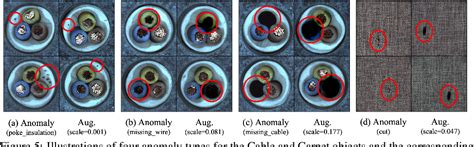 Figure 1 From End To End Augmentation Hyperparameter Tuning For Self Supervised Anomaly