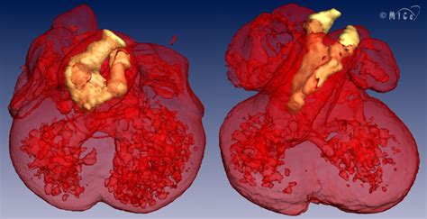 mice optical projection tomography