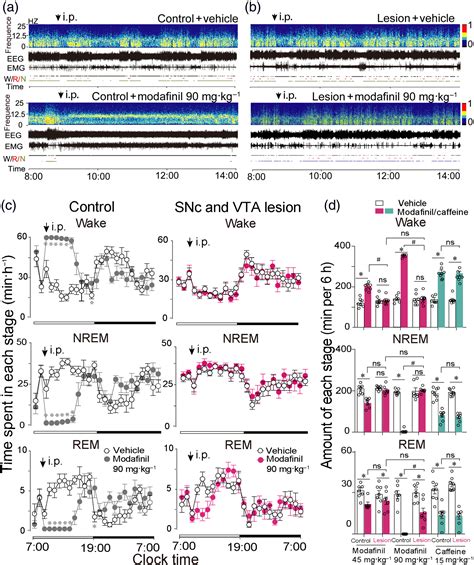 Mesencephalic Dopamine Neurons Are Essential For Modafinil‐induced