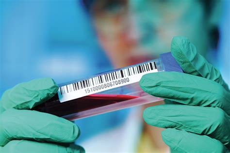 How Lab Directors Can Help Nursing Staff Eliminate Mislabeled Specimens Medical Laboratory