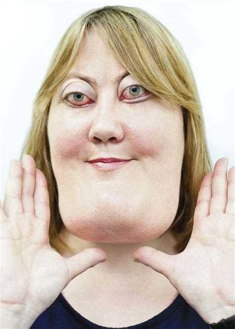 The Incredible Story Of Victoria Wright She Inspires Millions With Her