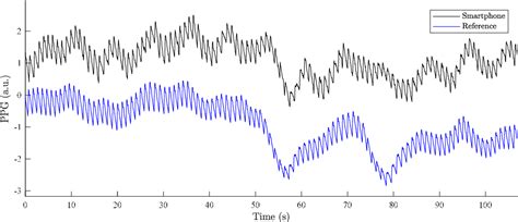 Figure 2 From Smartphone Ppg Validation For A Depression Assessment