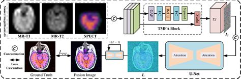 Figure 1 From Simultaneous Tri Modal Medical Image Fusion And Super