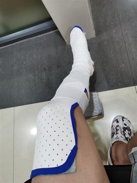 我的跟腱断裂手术及恢复过程 知乎