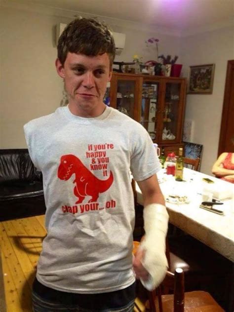 51 Hilarious Amputees Who Lost Their Limbs But Not Their Sense Of