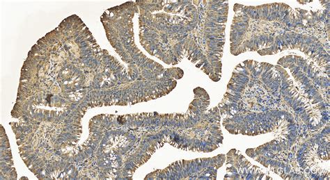 Pkm2 Specific Antibody 84451 1 Rr Proteintech