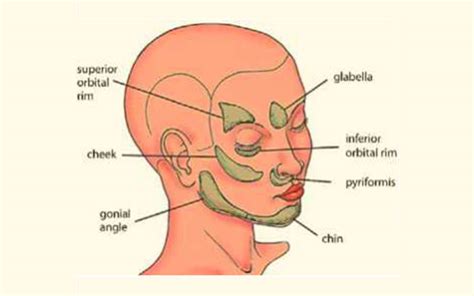 Facial Implants Cheek Chin Nose Jaw Angles Dr Hamilton