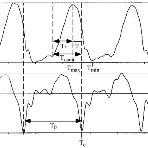 Source Filter Model Of Speech Production Download Scientific Diagram