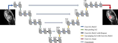 The U Net Convolutional Network For Fetal Brain Segmentation The