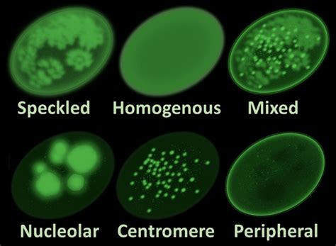 What Is The Difference Between Ana And Ana Titer Pediaacom