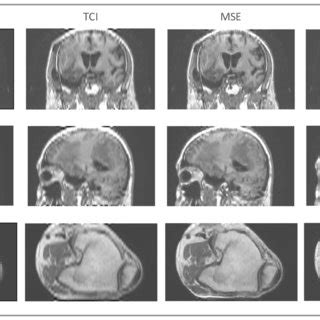 Pdf Soup Gan Super Resolution Mri Using Generative Adversarial Networks