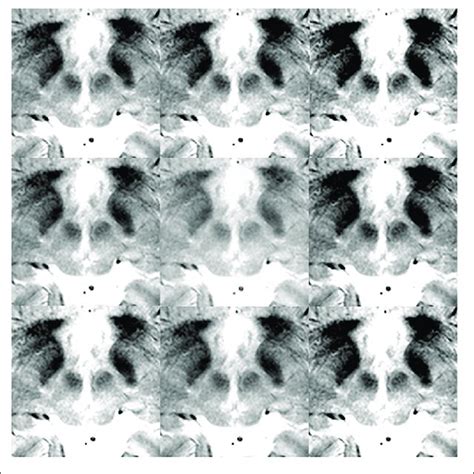 Data Augmentation Examples For Training And Validation Images