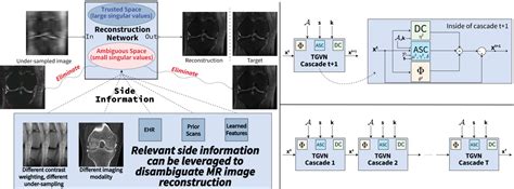 [논문 리뷰] A Trust Guided Approach To Mr Image Reconstruction With Side Information