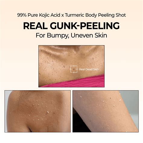 Drmelaxin Peel Shot Exfoliating Kojic Acid Turmeric Spray 200ml