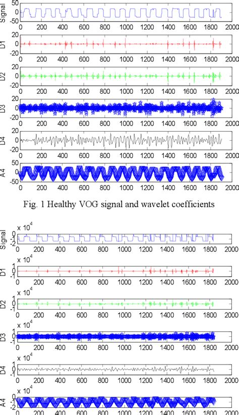 Figure 1 From Multi Layer Perceptron And Radial Basis Function Neural Network Models For