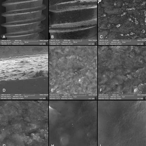 Micrographs Of Representative Samples Of Titanium Implants Sem Images Download Scientific