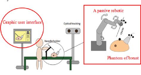 Figure 1 From On The Design And Development Of A Breast Biopsy Navigation System Path
